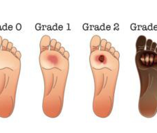 February 2021 Blogs | Brown & Barron, LLC